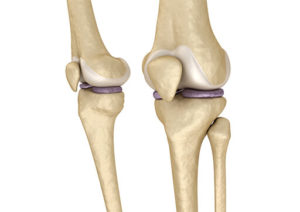 What is Patellofemoral Pain Syndrome | MyMSK Clinic Burnley Manchester