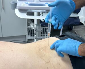 How Much Does a Cortisone Injection Cost Privately in the UK - My MSK