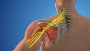 I Have a Pinched Nerve in My Shoulder Blade: Complete Guide to Relief ...